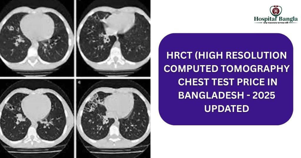 HRCT Chest Test Price in Bangladesh - 2025 Updated - HospitalBangla